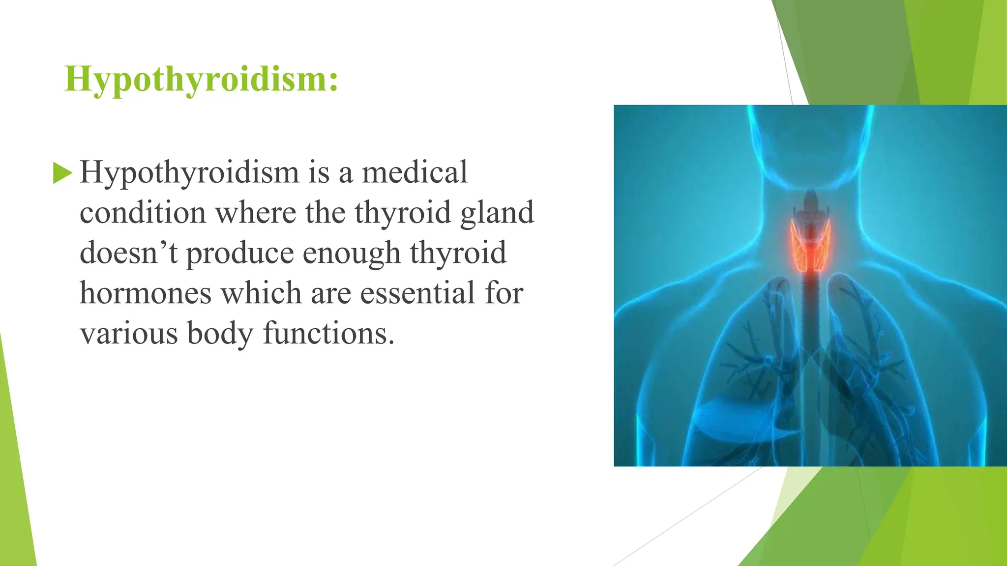 Hypothyroidism ppt by Aleena Mazhar.pptx