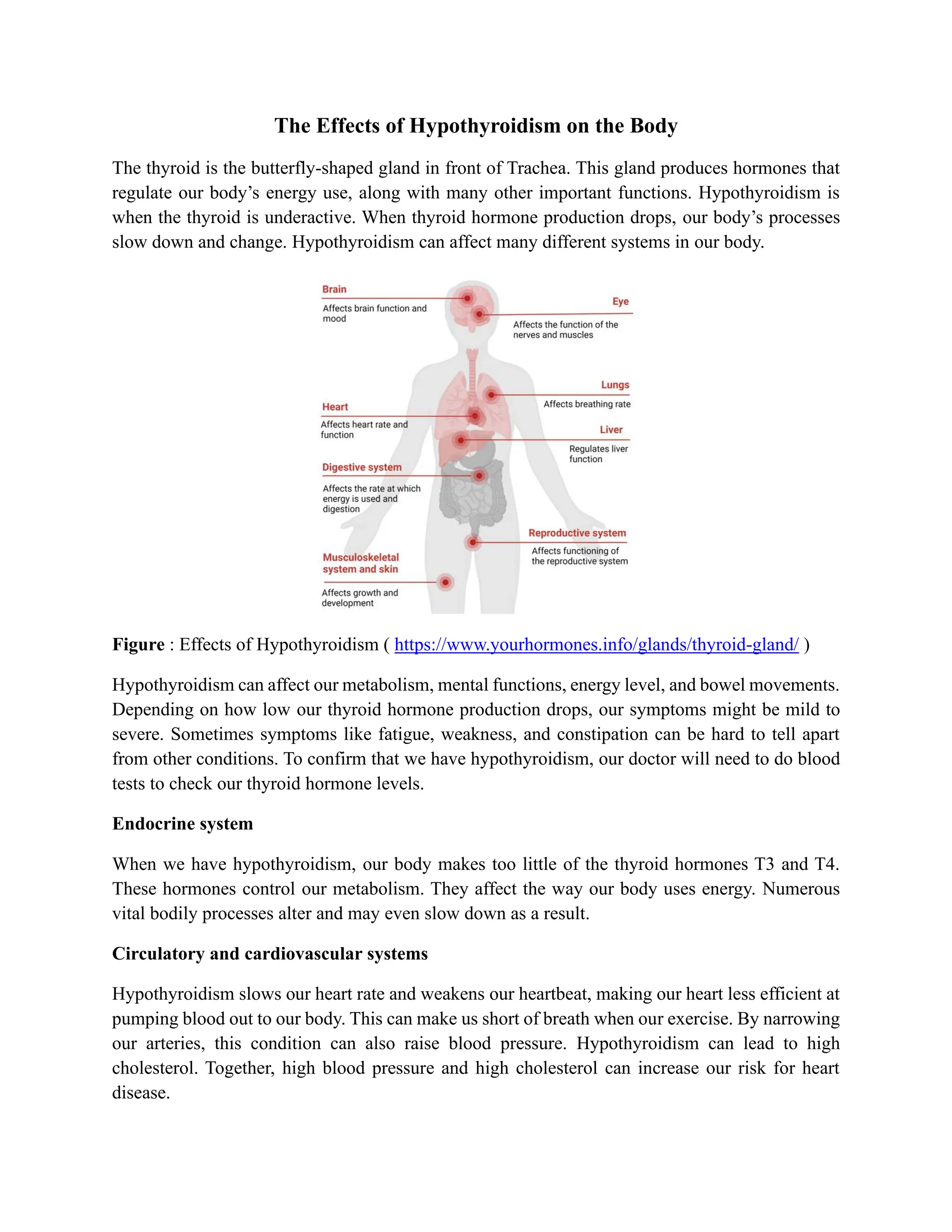 Hypothyroidism, Endocrine System, Thyroid gland | PDF
