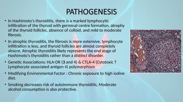 HYPOTHYROIDISM: CLINICAL FEATURES AND MANAGEMENT | PPTX