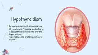 Hypothyroidism .pptx