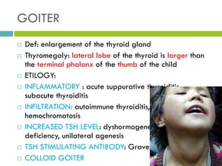 Hypothyroidism by aina | PPTX