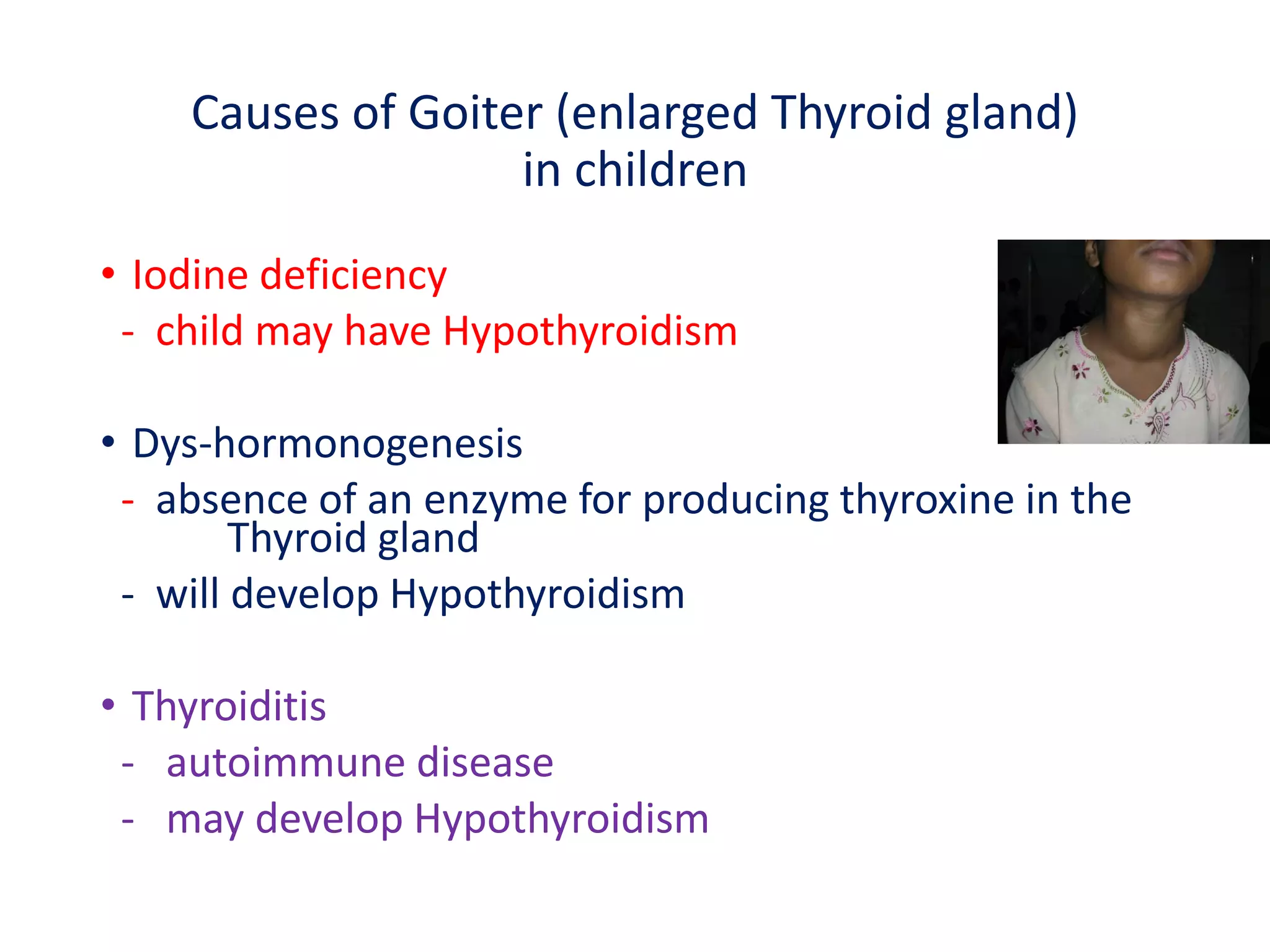 Hypothyroidism in children 2021 | PDF