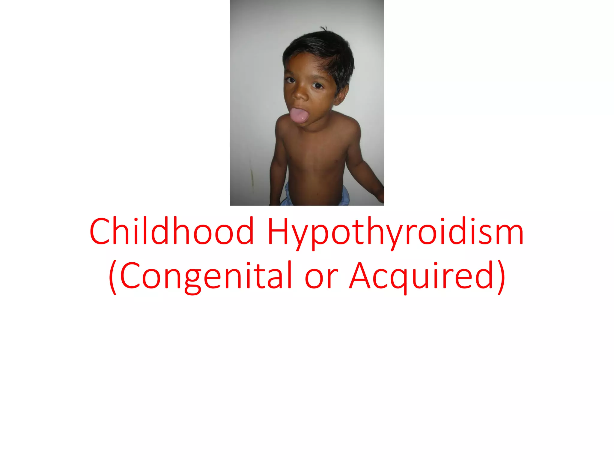 Hypothyroidism In Children Cks | Hypothyroïdie Enfant Age – TOMP