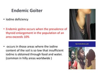 hypothyroidisminchildren2023 sahiwal.pptx