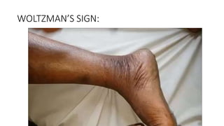 hypothyroidism for MBBS first year students | PPT