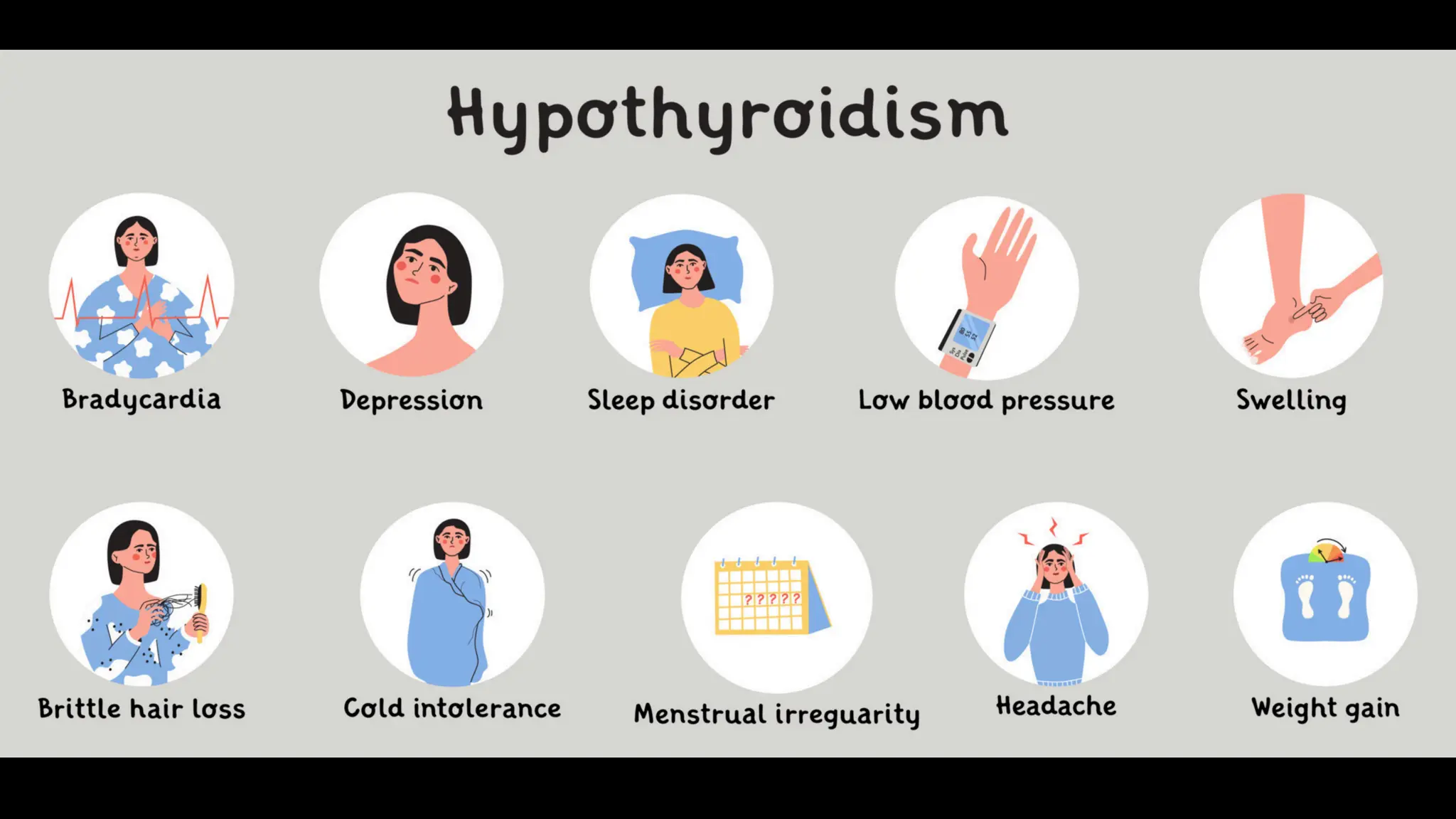 HYPOTHYROIDISM .pdf
