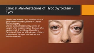 Hypothyroidism __________by (SRHF) .pptx