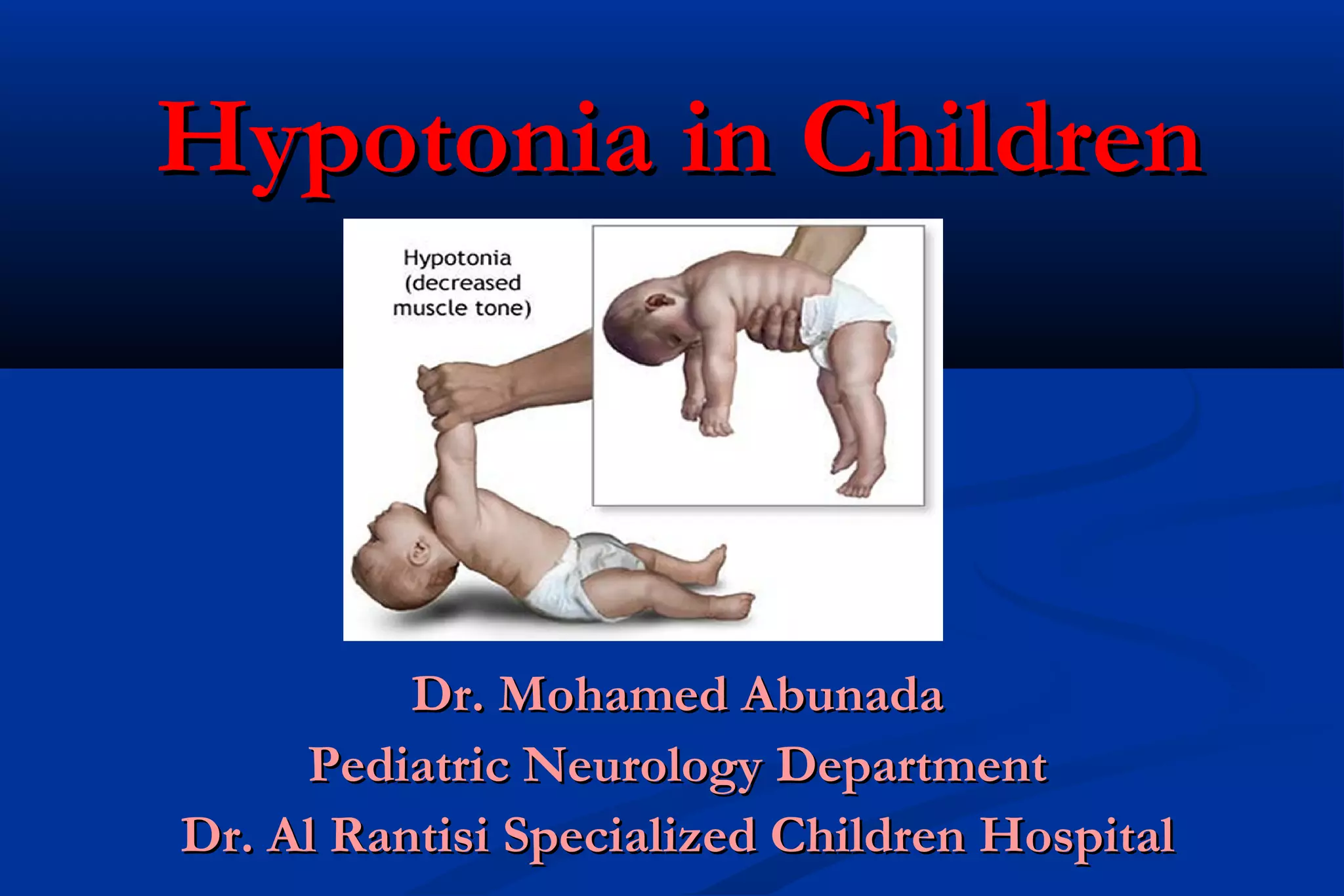 Hypotonia in children | PPT