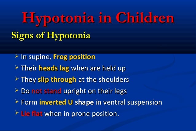Hypotonia in children