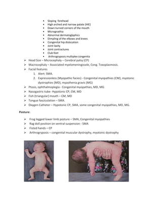 Hypotonic infant | PDF