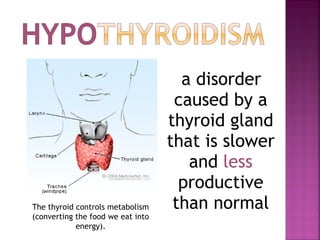Hypo vocabulary words | PPT