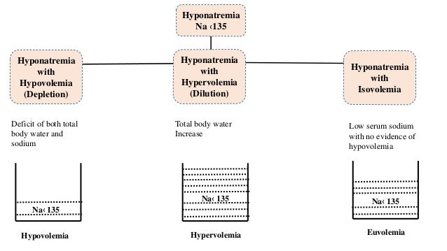 Hypo vs hypernatremia