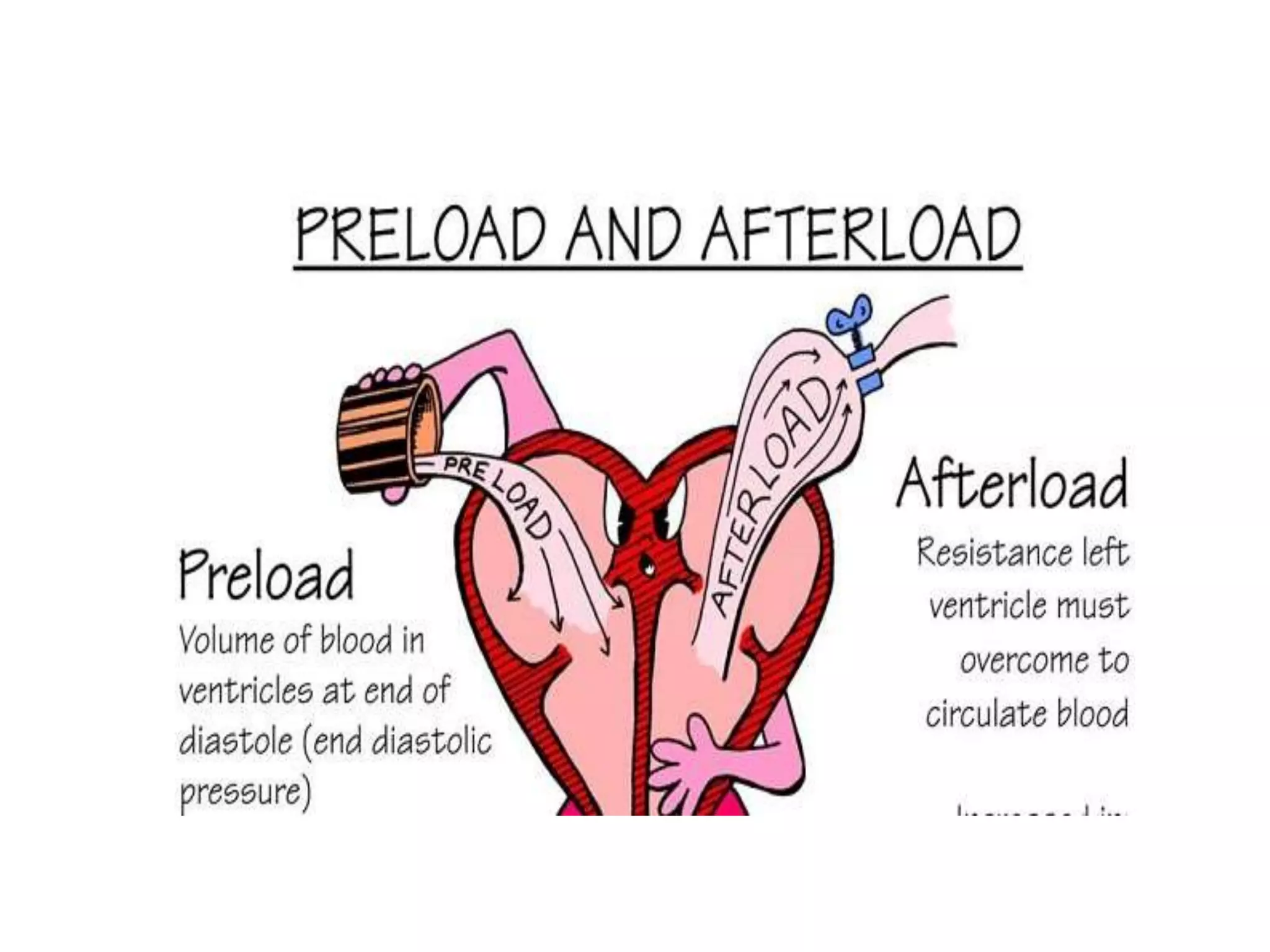 Hypovolemic shock ( related cardiac output) | PPTX
