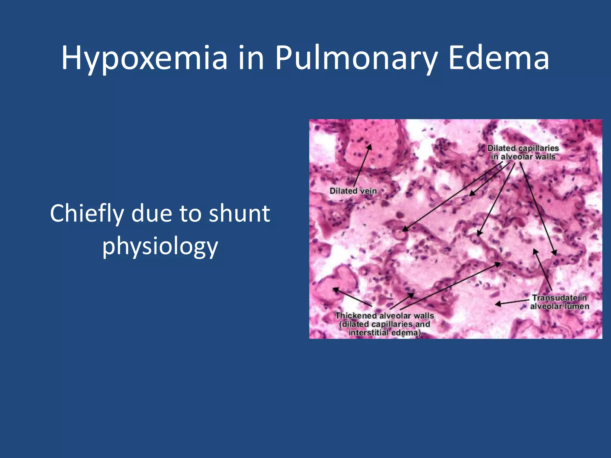 Hypoxemia for residents, 2 19-15 | PPTX