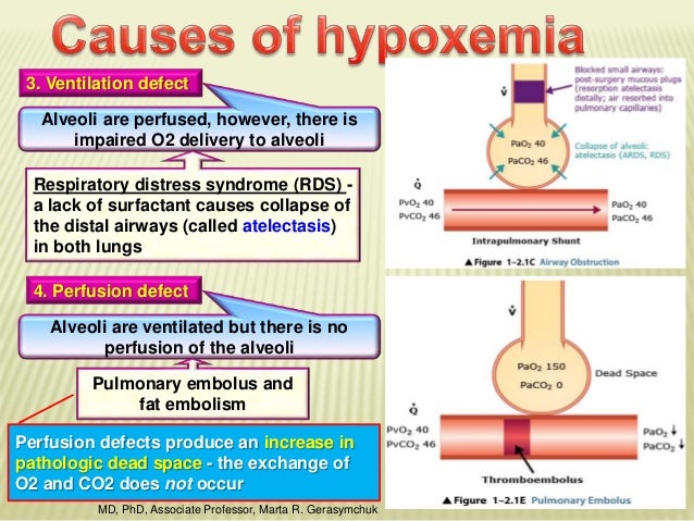 Hypoxia