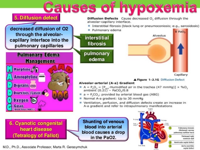 Hypoxia
