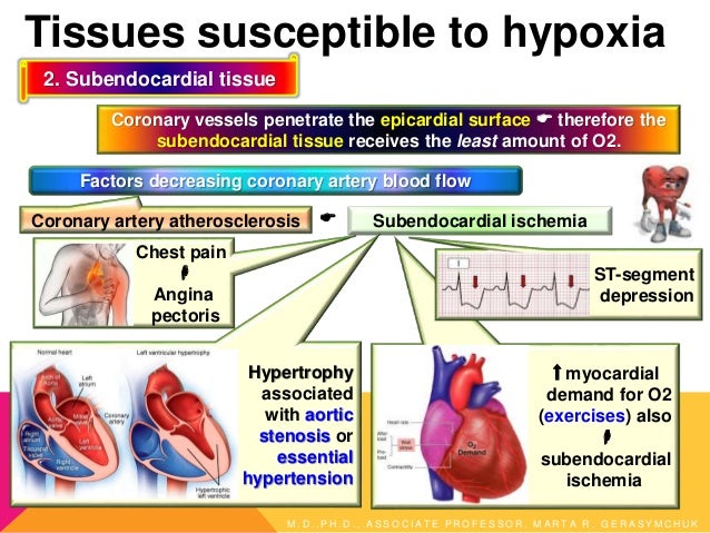 Hypoxia