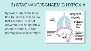 Hypoxia.pptx