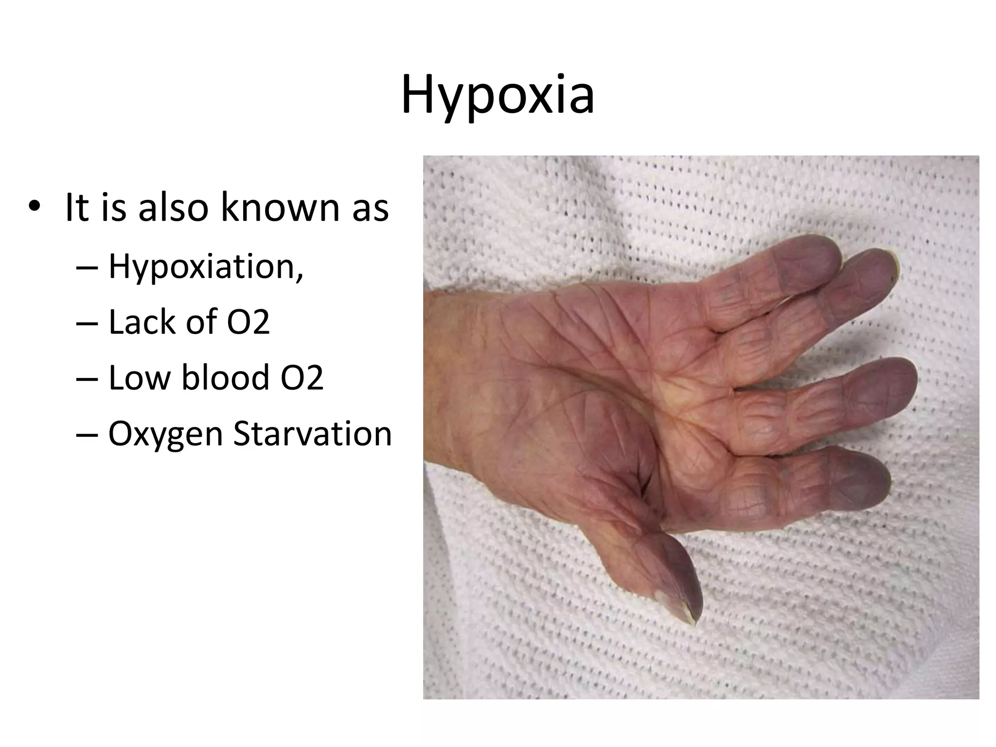 Hypoxia and its effects | PPTX