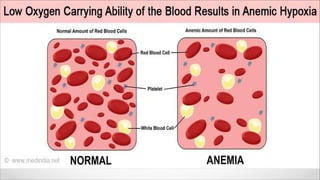 Hypoxia Respiratiory System; causes, classification, symptoms | PDF