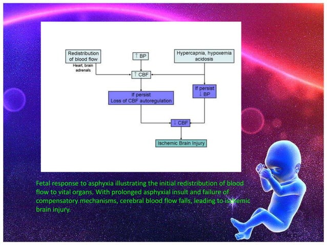 hypoxicischaemicencephalopathy-120430100906-phpapp02.pdf