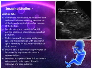 hypoxicischaemicencephalopathy-120430100906-phpapp02.pdf