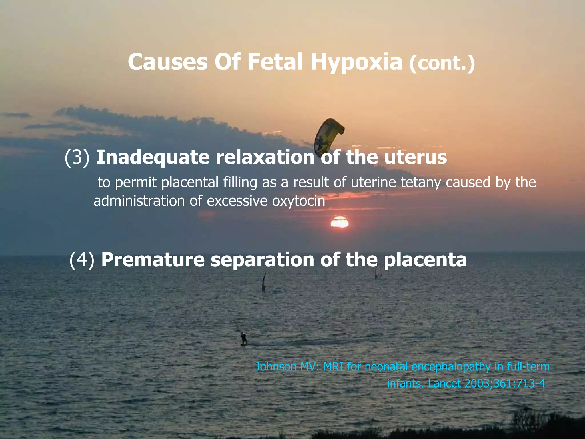 Hypoxic ischemic encephalopathy | PPT