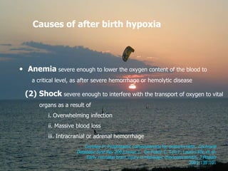 Hypoxic ischemic encephalopathy | PPT
