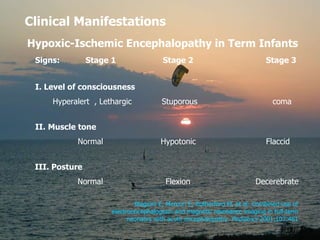 Hypoxic ischemic encephalopathy | PPT