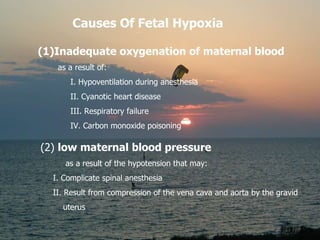 Hypoxic ischemic encephalopathy | PPT