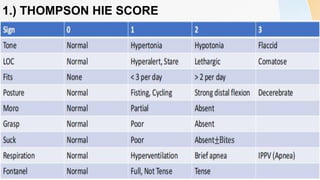 HYPOXIC ISCHEMIC ENCEPHALOPATHY/BIRTH ASPHYXIA.pptx