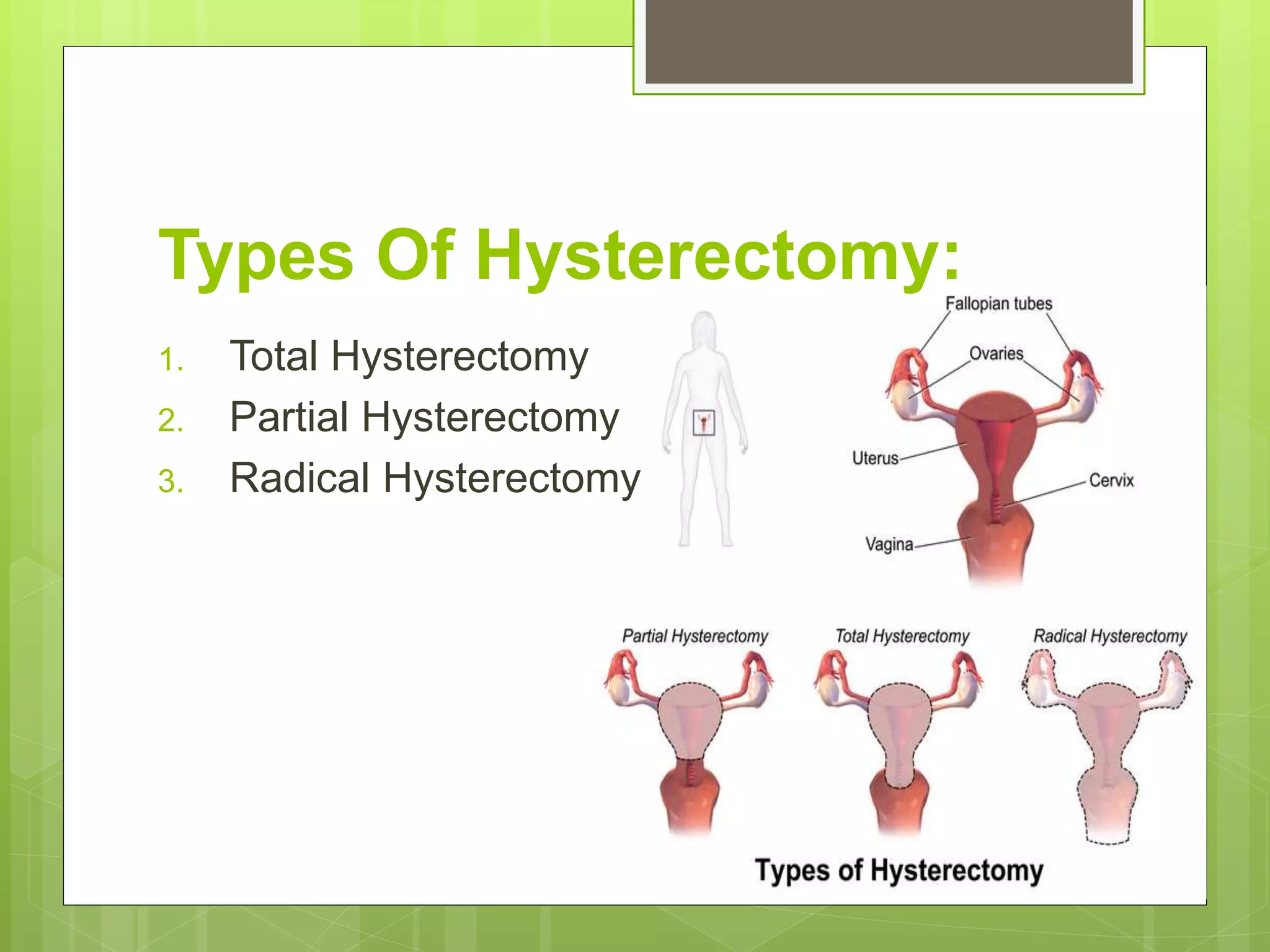 Hysterectomy | PPTX