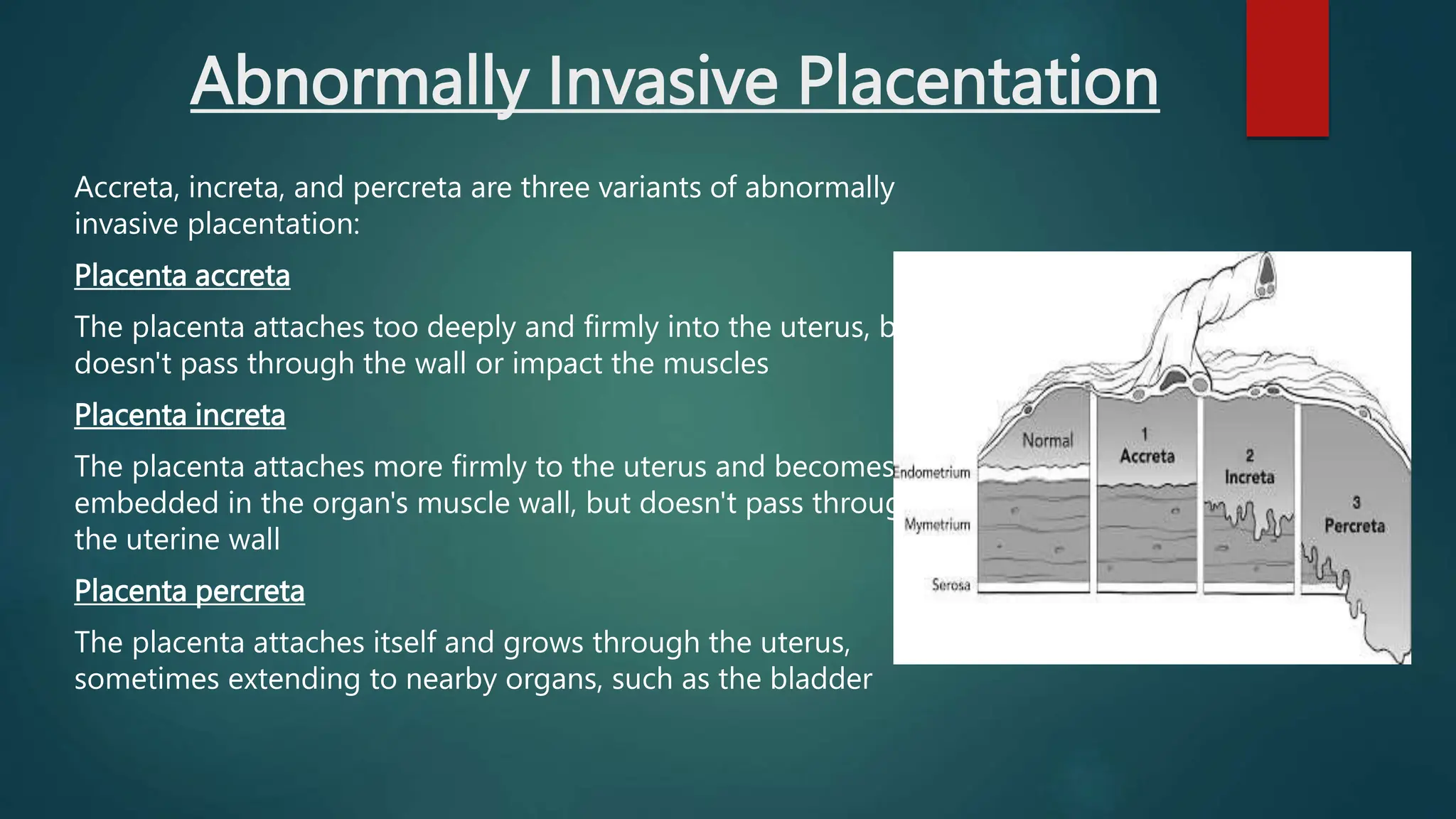 HYSTERECTOMY (Surgery and Post Surgical Physiotherapy management) | PPTX
