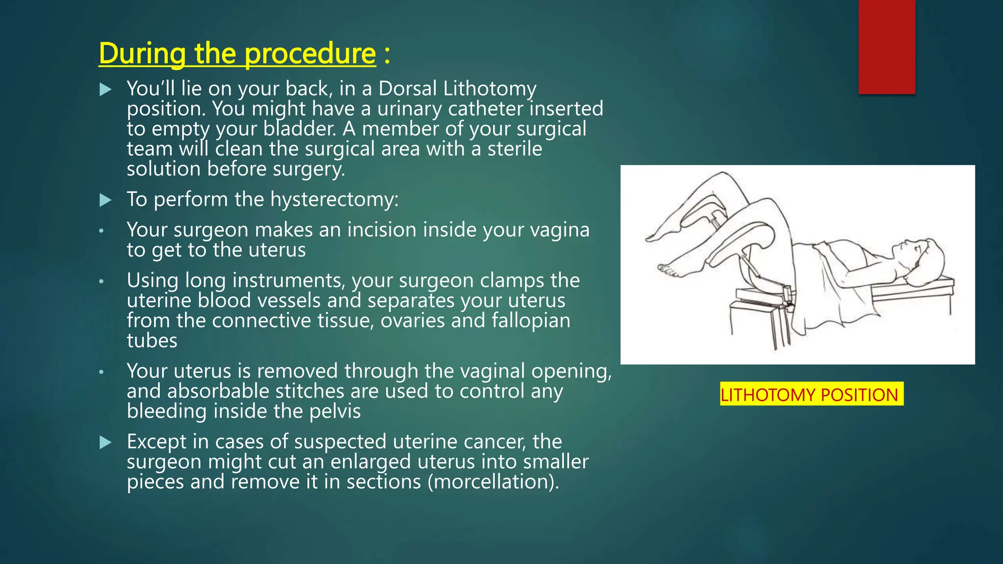 HYSTERECTOMY (Surgery and Post Surgical Physiotherapy management) | PPTX