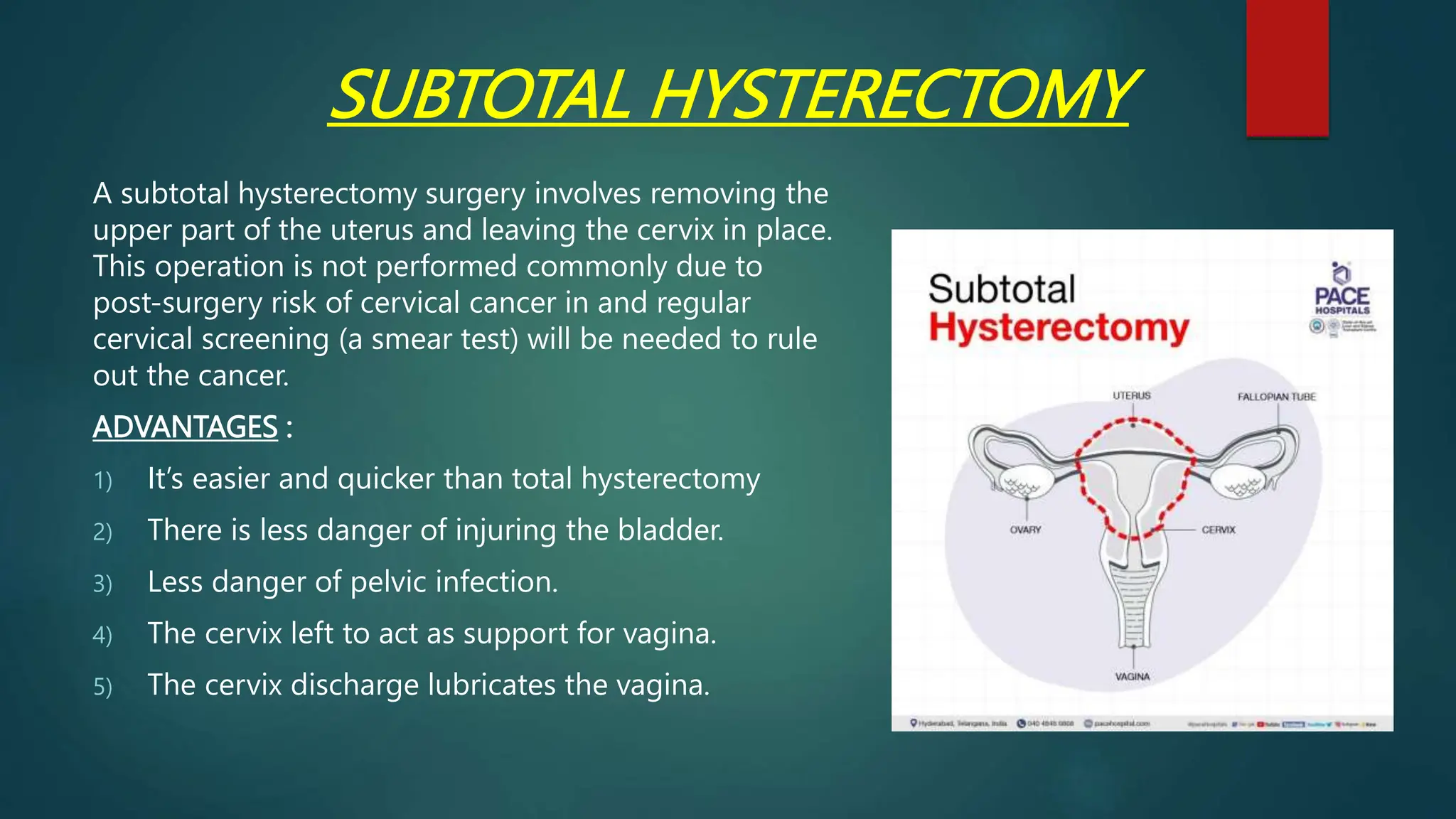 HYSTERECTOMY (Surgery and Post Surgical Physiotherapy management) | PPTX