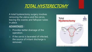 HYSTERECTOMY (Surgery and Post Surgical Physiotherapy management) | PPTX
