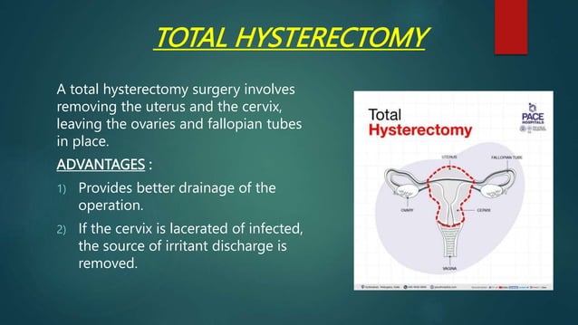HYSTERECTOMY (Surgery and Post Surgical Physiotherapy management ...