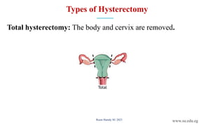 Hysterectomy 2023.pdf