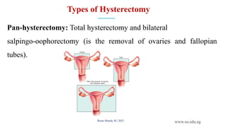Hysterectomy 2023.pdf