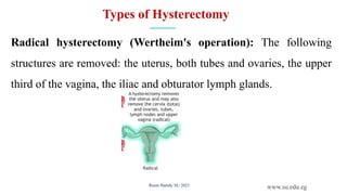 Hysterectomy 2023.pdf