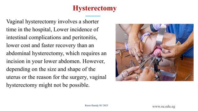 Hysterectomy 2023.pdf