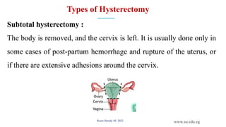 Hysterectomy 2023.pdf