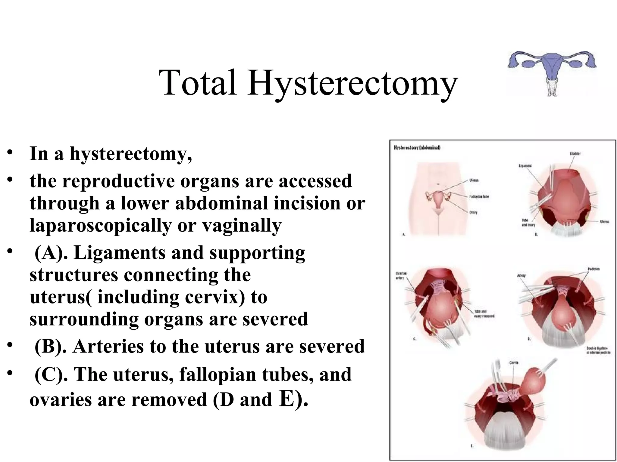 Hysterectomy decision el-hennawy | PPT