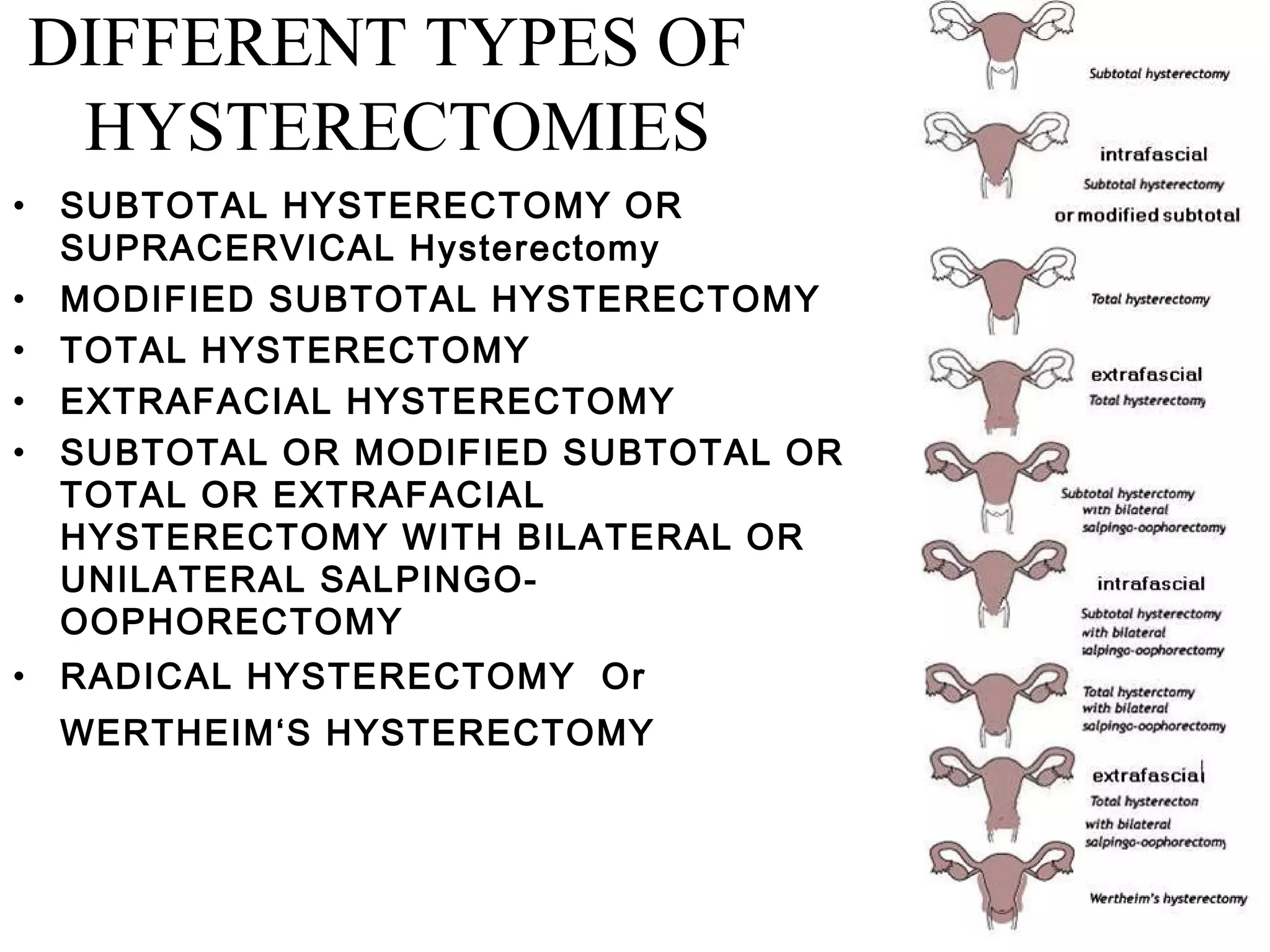 Hysterectomy decision el-hennawy | PPT