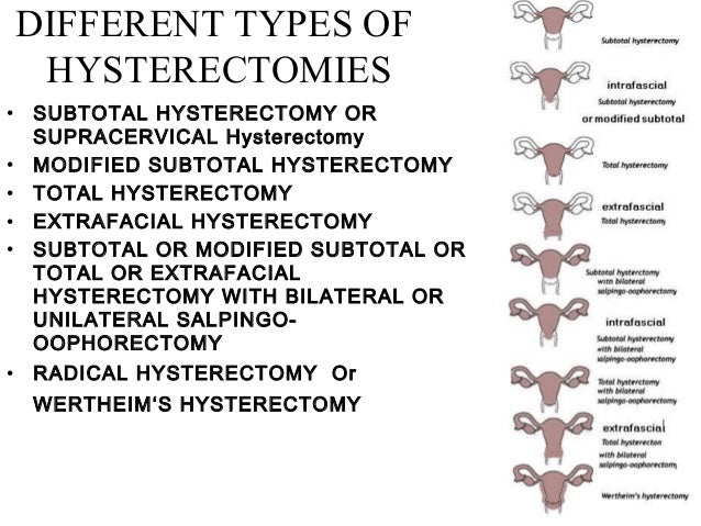 Hysterectomy decision el-hennawy