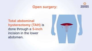 Best Hospital for Hysterectomy in Hyderabad | Hysterectomy Laparoscopic ...