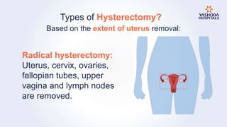Best Hospital for Hysterectomy in Hyderabad | Hysterectomy Laparoscopic ...