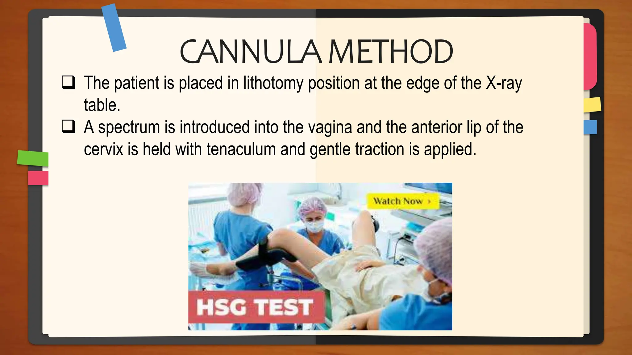 HYSTEROSALPHINGOGRAPHY - Radiology :1st Year Anatomy. | PPTX