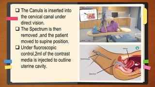 HYSTEROSALPHINGOGRAPHY - Radiology :1st Year Anatomy. | PPTX