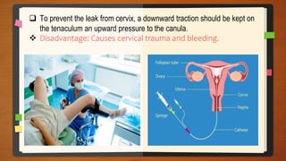 HYSTEROSALPHINGOGRAPHY - Radiology :1st Year Anatomy. | PPTX